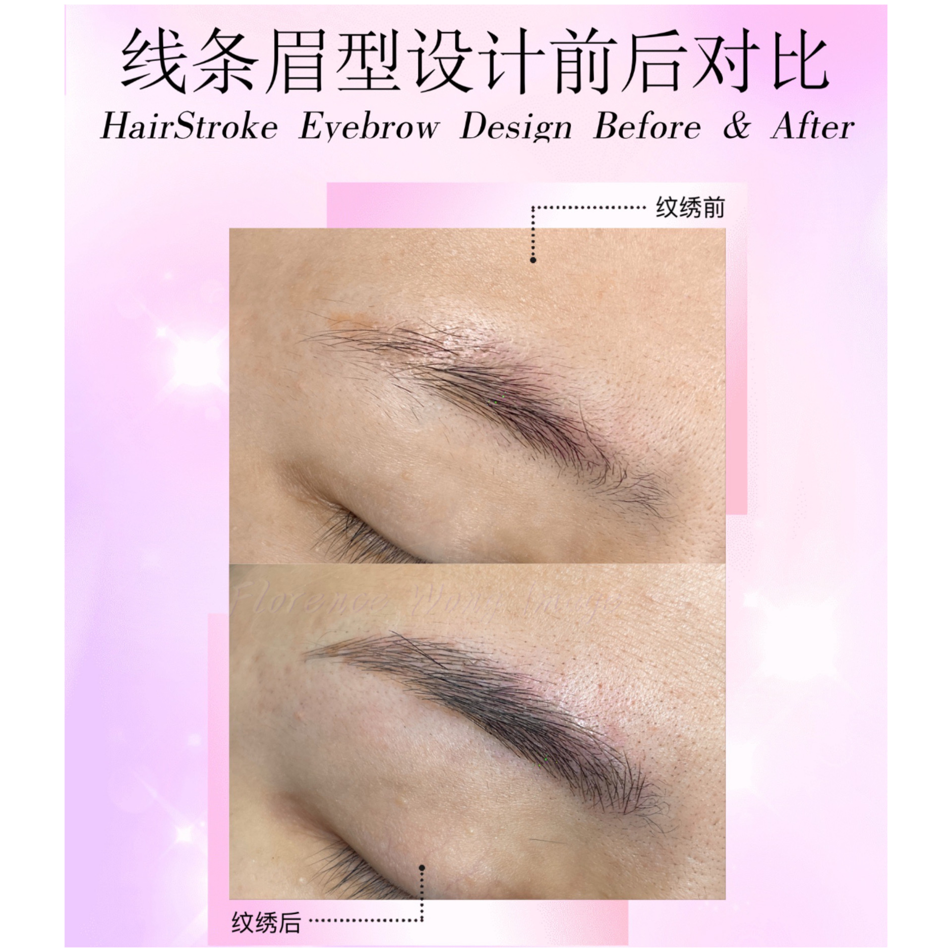 Eyebrow Microblading ~ Concealed Old Tattooed Brow - Florence Wong ...