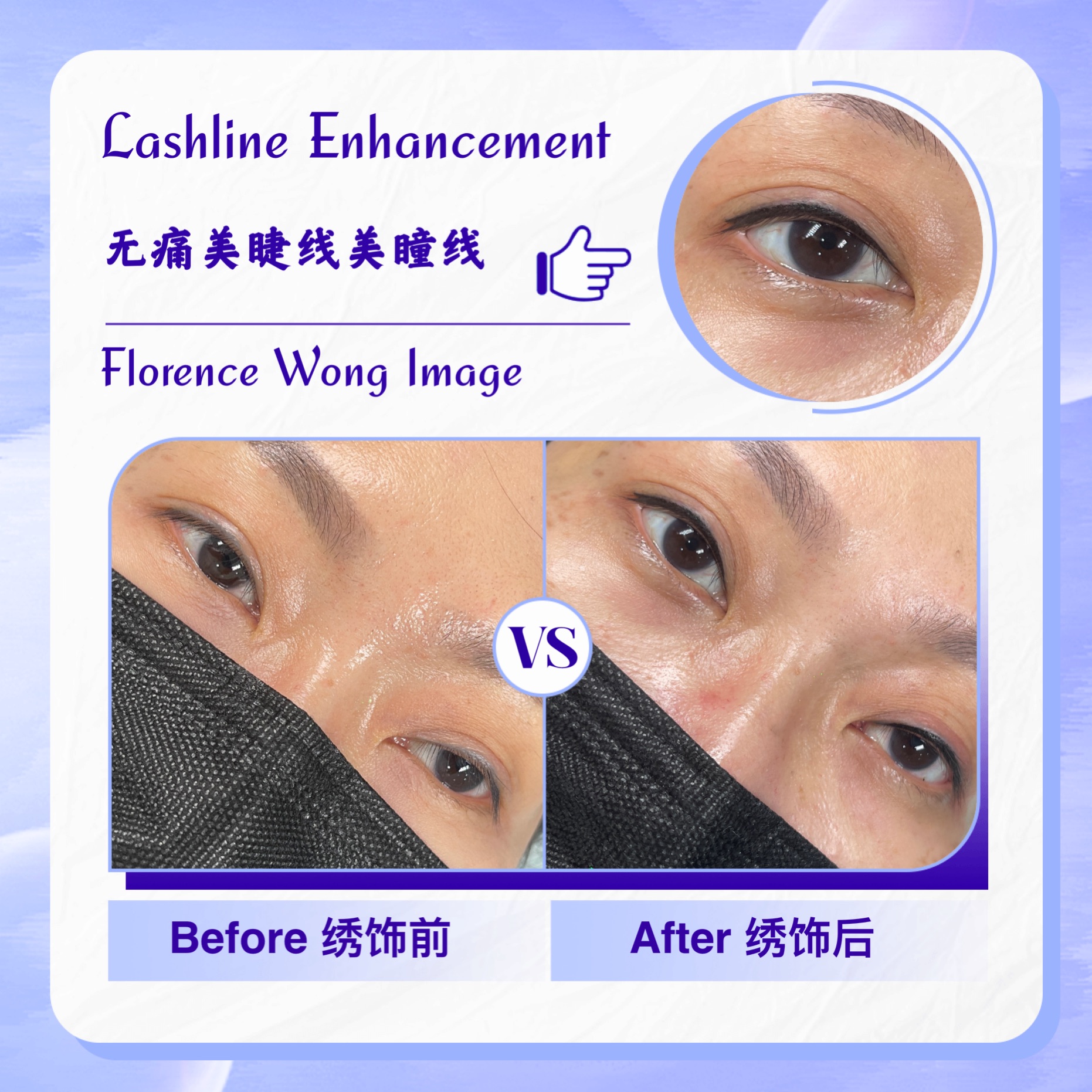Painless Lashline Enhancement - Florence Wong Weblog - Professional ...